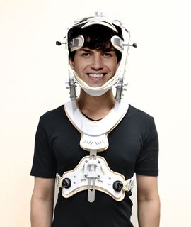 Medex. cervical fracture, dislocation or Post-Op. , 高位頸椎骨折 , 高位頸椎脫位 , 術後固定